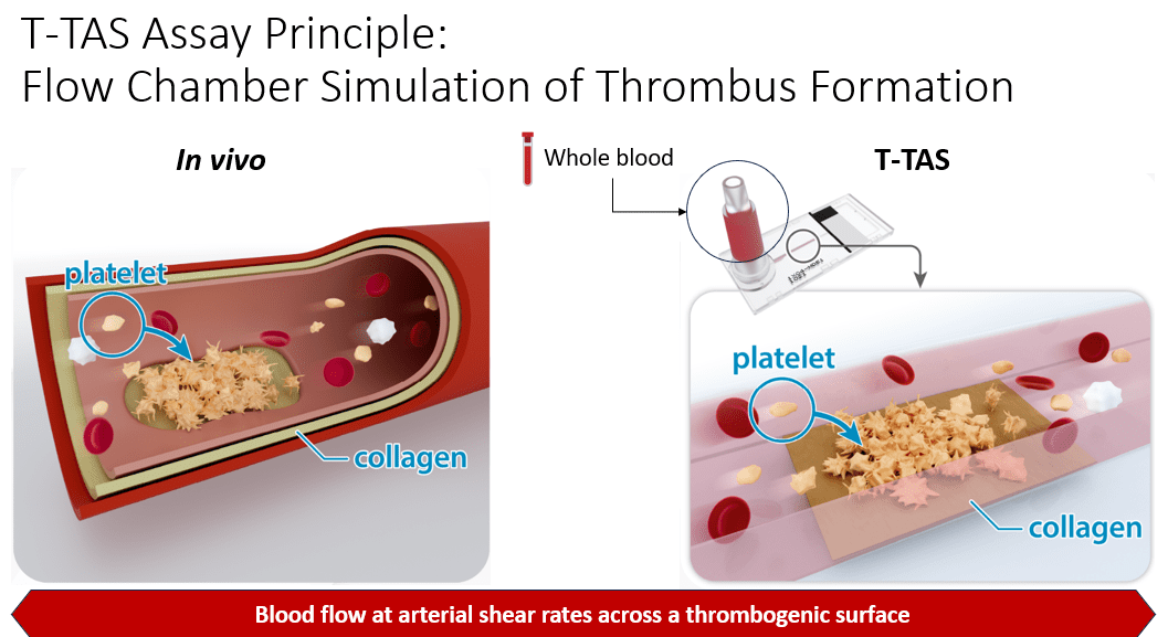 Discover the T-TAS 01 - the way to measure physiological total platelet function - DiaPharma